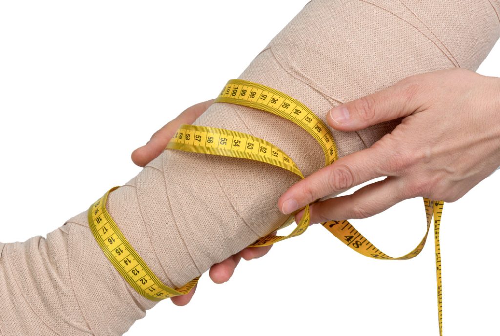 リンパ浮腫になったらどうする？リンパ浮腫が治った例や外来治療、セルフケアについて | 男性不妊治療・手術は銀座リプロ外科